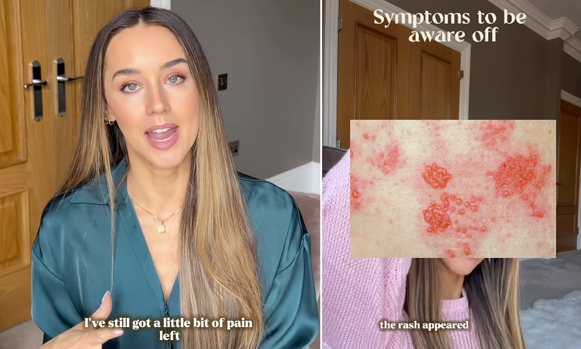 Peter Andre’s Wife Emily Shares Health Update Post Shingles Diagnosis ...